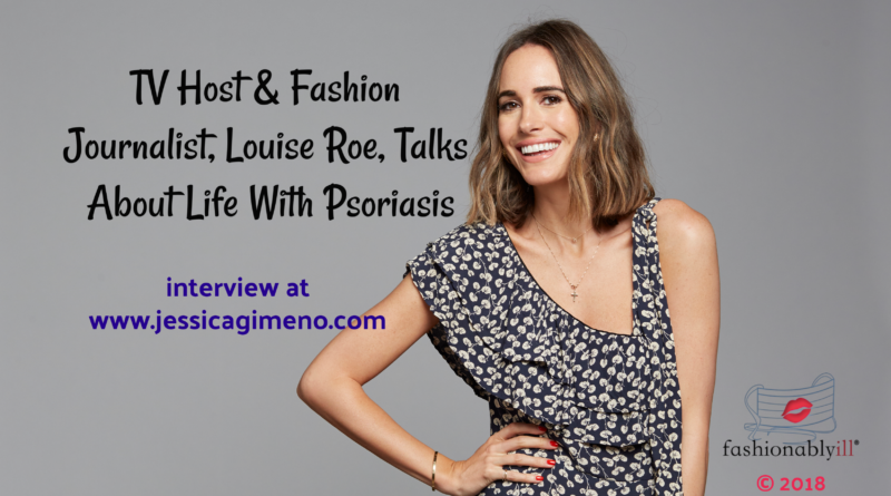 TV Host Louise Roe On Life With Psoriasis – Fashionably ill